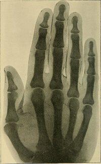 10 Hand Safety and Hand Injury Prevention Tips - Online Safety Trainer